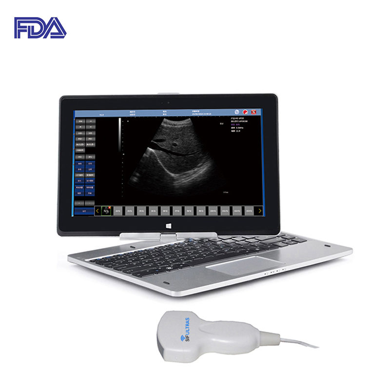 Laptop Ultrasound Scanner SIFULTRAS-9.1 - SIFSOF