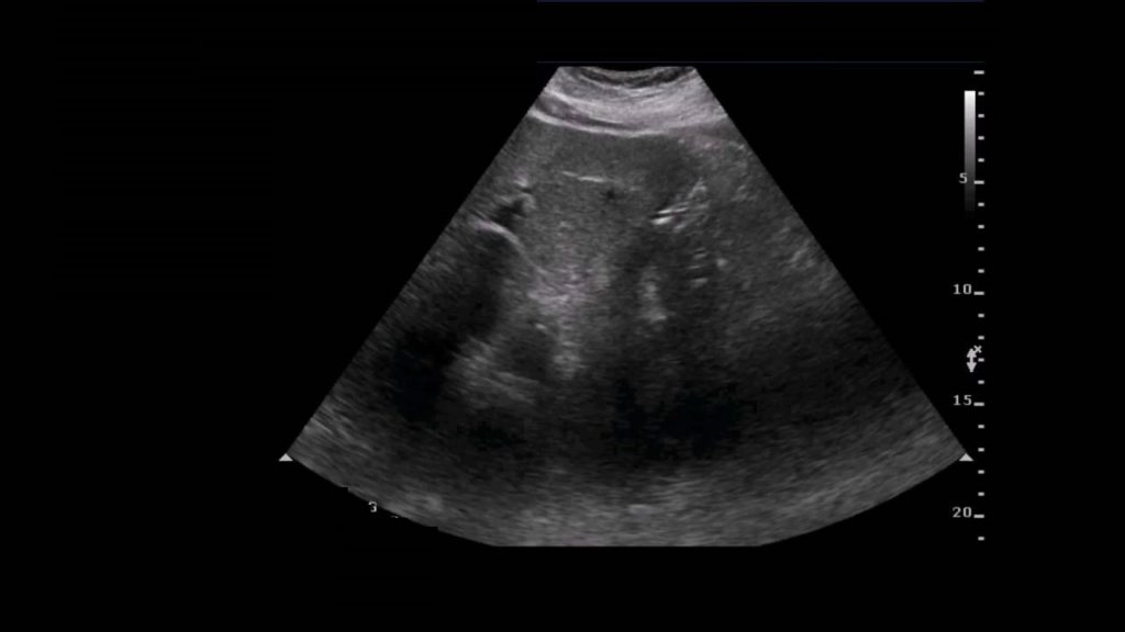 Confirmation of Nasogastric Tube Placement - SIFSOF